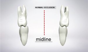 Dental Occlusion Treatment: Caused By Overall State Of Your Bite