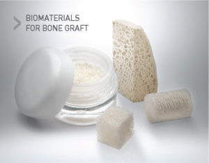 Bone Graft Dental: Procedure, Recovery, and Why It’s Essential